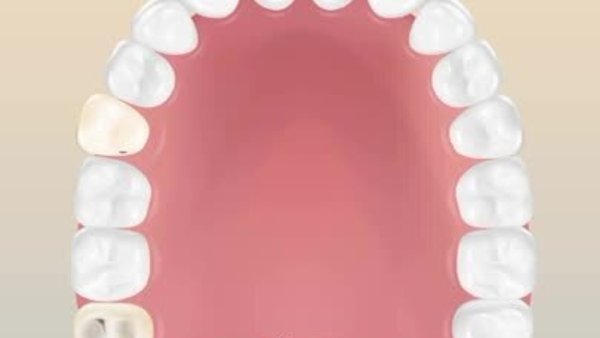 Zahnarzt #zahnarzt #dentist #meme Quellen: [Q1] Envivas – Zahnarztsprache und Befundkürzel [Q2 ...